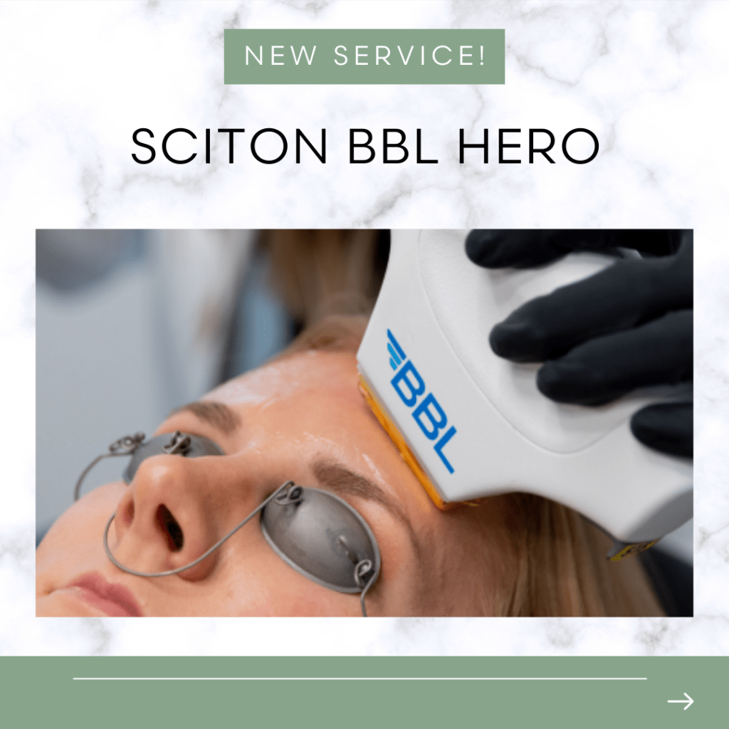 Say Hello to our New Hero: The Sciton® BBL Hero™ Laser