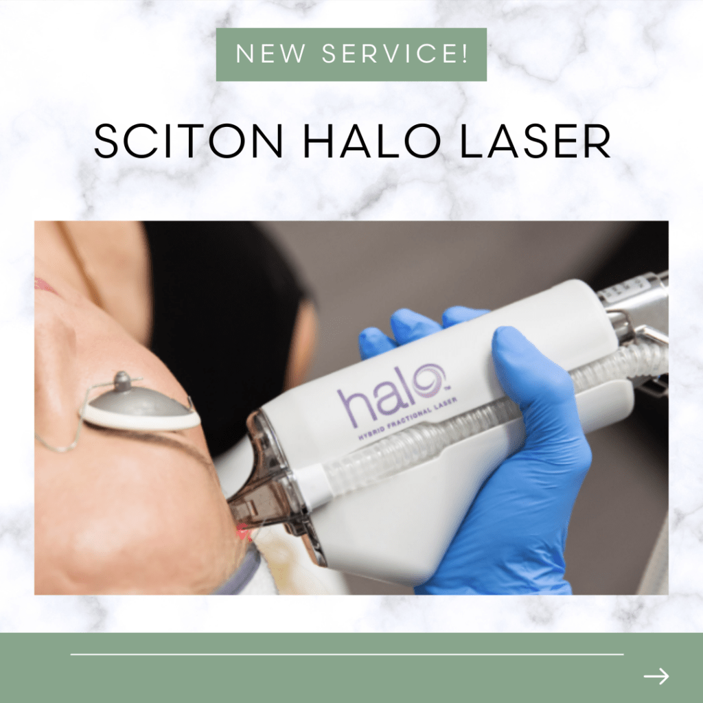The Sciton® Halo™ Laser | Eyes, Lids & Face Clinic