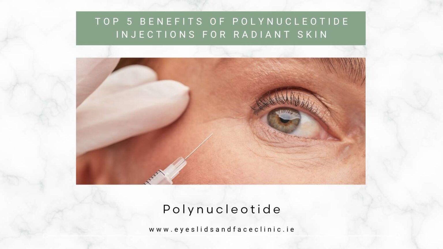 Top 5 Benefits of Polynucleotide Injections for Radiant Skin | Eyes ...
