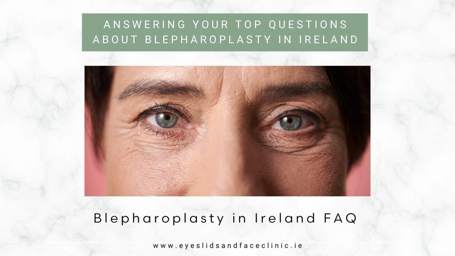 Answering Your Top Questions About Blepharoplasty in Ireland | Eyes ...